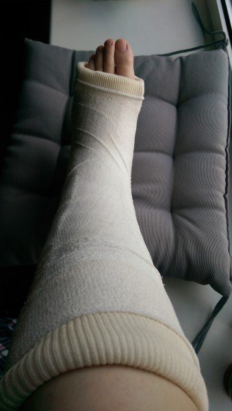 Sessão de Quinta: Engessada | Imaginação Fértil